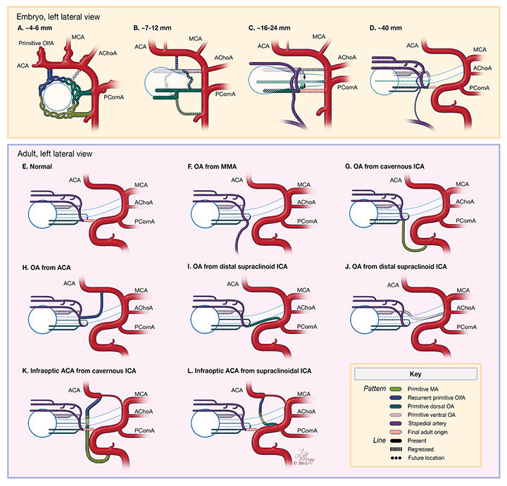 Neurovascular Development Studies | Visualization Core Lab in Radiology ...